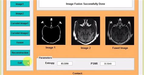 image fusion using curvelet transform matlab project with source code