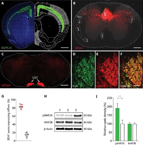 Fezf2 Creer Conditionally Targets Layer V Corticospinal Projection