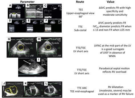 Main Parameters For Hemodynamic Monitoring Using Critical Care Download Scientific Diagram
