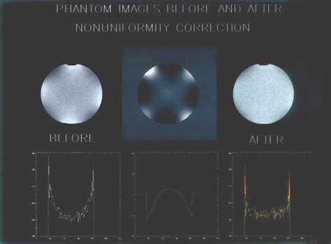 Nonuniformity Correction Applied To A Phantom The Upper Panel Consists