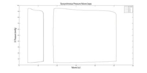 Volume Waveforms Of Mass Dyssynchrony Download Scientific Diagram