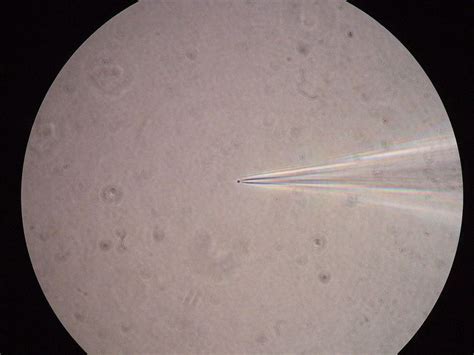 Patch Clamp Alchetron The Free Social Encyclopedia