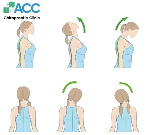 Cervical Spondylosis Exercises