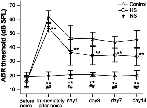 Noise Induced Abr Threshold Shifts Immediately After Noise Exposure
