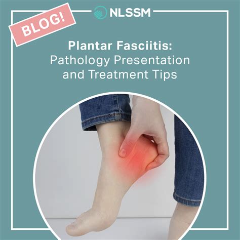 Plantar Fasciitis Pathology Presentation And Treatment Tips Nlssm