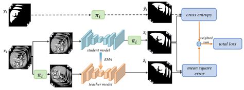 Our Transformation Consistent Self Ensembling Model Tcsmv2 For