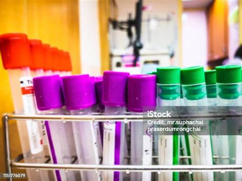 다채로운 배경 혈액 샘플 다른 환자를 위한 색상 튜브의 랙 실험실 기술자 개념입니다 Lcd에 대한 스톡 사진 및 기타 이미지 Lcd Stem 주제 건강 진단 Istock