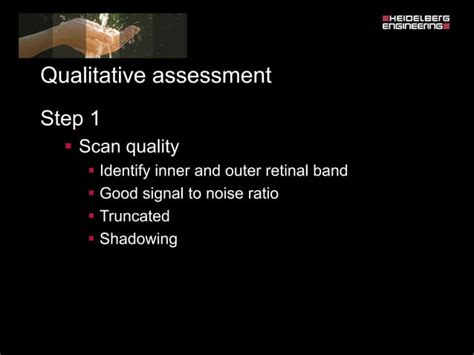 Spectralis Oct Normal Anatomy And Systematic Interpretation Pdf Eye And Vision Conditions