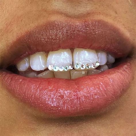 Pin On Strass Dentaire Teeth Jewelry Diamond Teeth Dental Jewelry