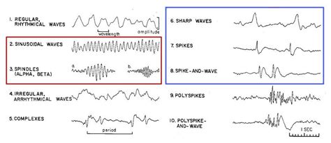 Eeg Based Seizure Detection