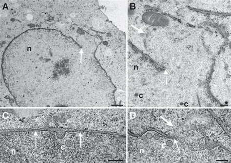 Herpes Virus Electron Microscope