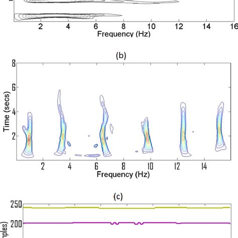 A Tf Of Eeg Spike Signal B Tf Representation Obtained By The Rotating