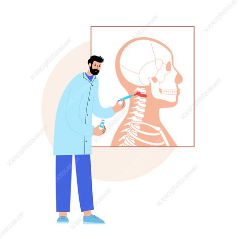 Spinal Injection Illustration Stock Image F0365579 Science