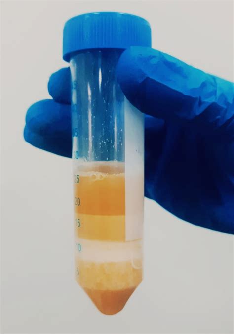 Centrifugation Density Gradient Free Photo On Pixabay Pixabay