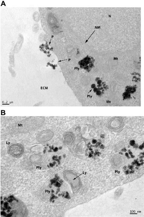 Qualitative Uptake Of The Ios Loaded Tpgs Micelles Using Transmission Download Scientific