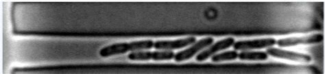 Pythonopencv — Matching Centroid Points Of Bacteria In Two Images