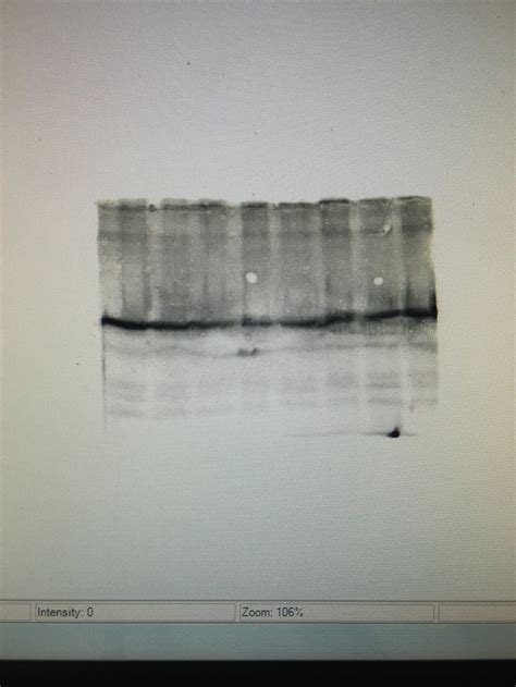 13 Questions With Answers In Western Blot Normalization Science Topic