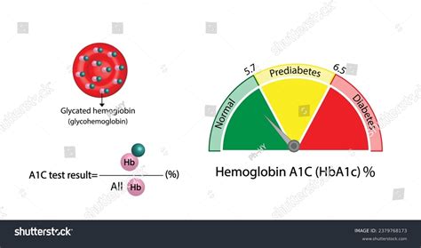 Hemoglobin A C Hba C Test Hba C Levels Stock Vector Royalty Free