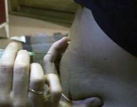 Details Of An Intramuscular Injection 日本語で Details Of An Intramuscular Injection 日本語で