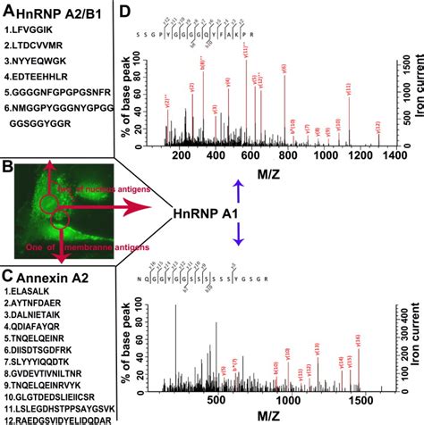Hnrnp A1 And Hnrnp A2 B1 Antibodies Were Detected Co Existed In One Download Scientific Diagram