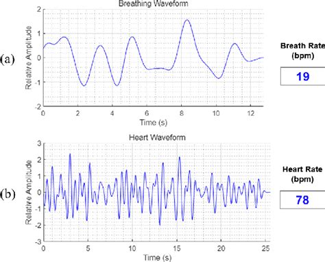 Figure 1 From Non Contact Realtime Vital Signs Monitoring System Based On Millimeter Wave Fmcw