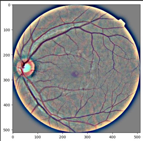 Eyesnap Diabetic Retinopathy Detection With Diascan Devpost