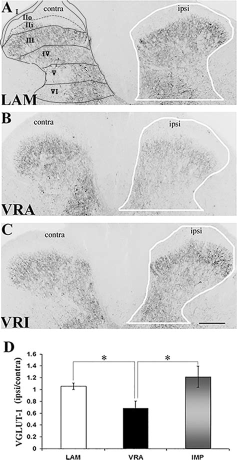 Effects Of A Unilateral L6 S1 Ventral Root Avulsion Vra Injury