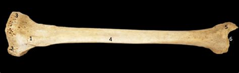 TIBIA Diagram Quizlet