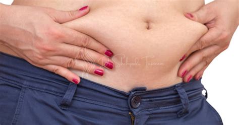 How Is A Tummy Tuck Procedure Performed Best Female Plastic Surgeon In Dubai Dr Shehzadi Tasneem