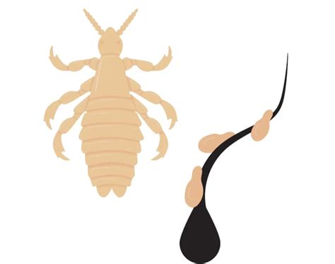 What Do Genital Crabs Look Like Pubic Lice Pubic Crab Pediculosis