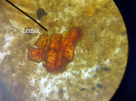 Rizqi Murtafi Ah Pemeriksaan Feses Lengkap