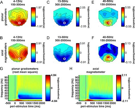 amplitude components of sensor space oscillatory responses
