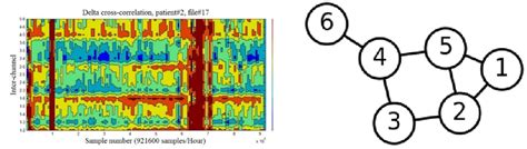 Delta Cross Correlation At The Approach Of A Seizure Pre Ictal Phase