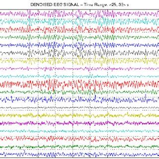 Spectrogram Example Download Scientific Diagram