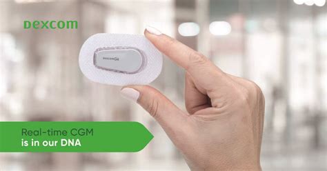 Dexcom Uk And Ireland On Linkedin Continuousglucosemonitoring Cgm Diabetes