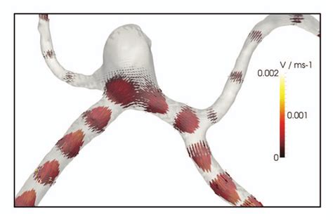 Velocity Predictions Based On Hemelb Flow Simulations In An Aneurysm Download Scientific