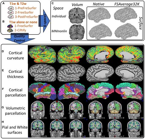 Illustration Of The Ciftistorm Structural Processing Pipeline Top Row Download Scientific