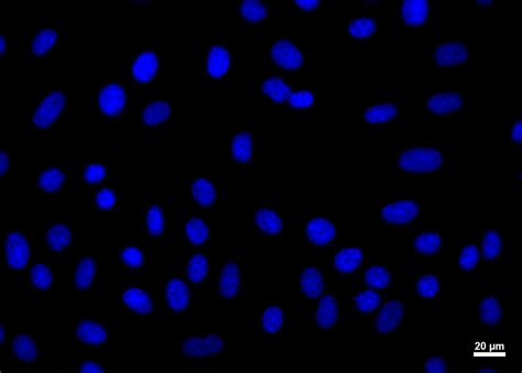 Troubleshooting For Streaky Dapi With Methanol Fixation