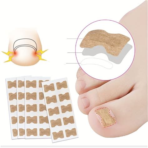 Toenail Care Patch Ingrown Toenail Corrector Stickers Paronychia