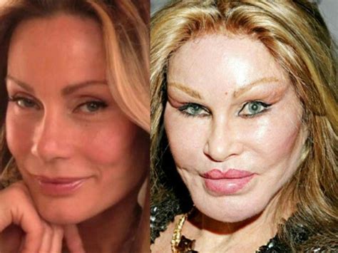 Jocelyn Wildenstein New York Socialite Now Known As The Cat Woman