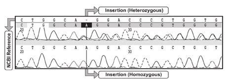 electropherogram showing homozygous and heterozygous insertion all