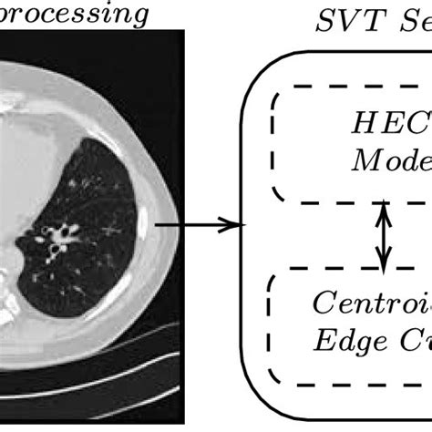 Segmentation Model Of Ct Image Download Scientific Diagram Segmentation Model Of Ct Image Download Scientific Diagram