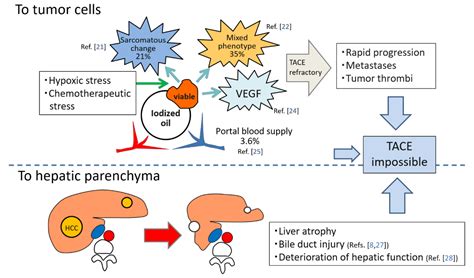 Applied Sciences Free Full Text Treatment Strategy Of Transarterial Chemoembolization For