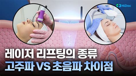 레이저 리프팅 고주파 Vs 초음파 다른 점은 Youtube