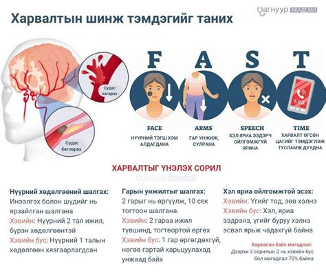 Анхны Цус харвалтын үед илрэх шинжүүд болон үнэлэх аргыг мэдээд