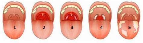 Мнения за Ангал спрей ментол таблетки за смучене Купи тук ЗдравеОрг