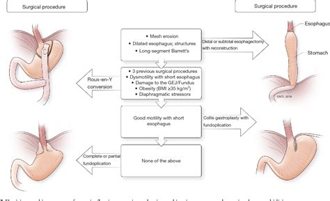 Antrectomy