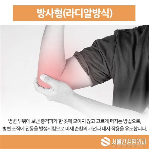서울선정형외과 근골격계 질환은 근육 뼈 신경 관절 인대 등의 문제로 통증이나 신체기능의 장애를