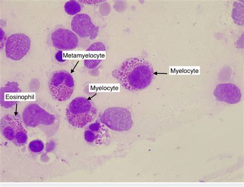 Myelocyte Metamyelocyte And An Eosinophil Exhibiting Giant Download Scientific Diagram