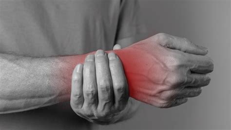 Severe Wrist Pain Physiotherapy Rep Physio